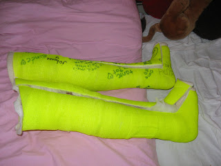 Eileen's place: Dag gips, hallo loopgips