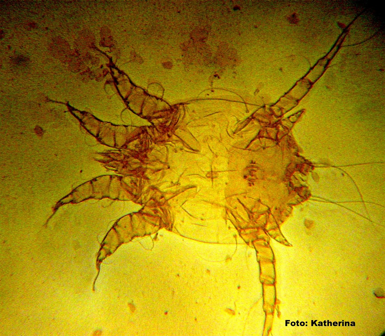 BLOG DA KAT: Psoroptes