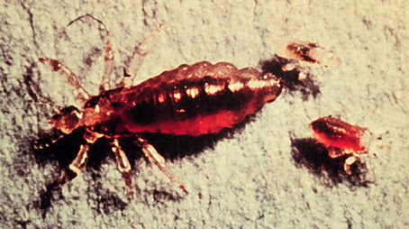 Our Banana Moments: What are head lice (Uku)?