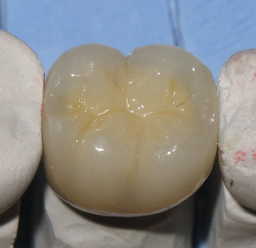 Authorized 3M Lava Milling Center