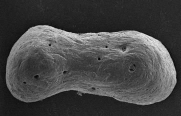 BLOG DE LA CATEDRA DE ENDODONCIA USAL/AOA: ANALISIS DEL ÁPICE DE UNA ...