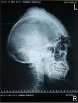 Nothing To Do With Arbroath: Real life Elephant Man