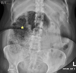 RiT radiology: July 2010