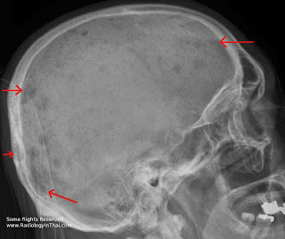 RiT radiology: May 2008