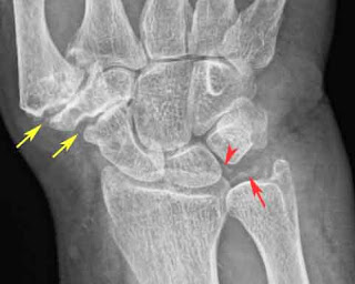 RiT radiology: November 2008