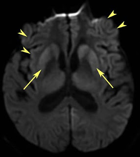 RiT radiology: February 2009