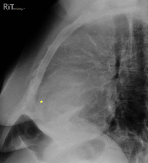 RiT radiology: February 2010