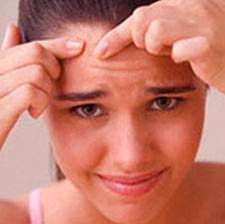 GENERAL HEALTH 101: Acne and Pimples Prevention and Treatments