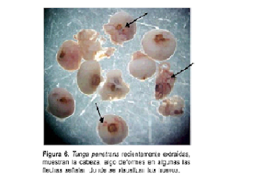 ARTROPODOS: TUNGA PENETRANS (NIGUA)