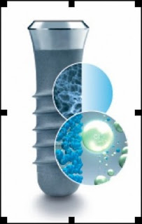 IMPLANTE / Dr Ricardo Denser: Implantes Strauman SLA active