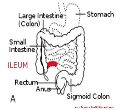 TooSogiE Medical Images: IMAGES OF CROHN'S DISEASE