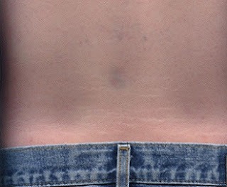 Kamloops British Columbia Canada UFO Research: Photos Of Large Scoop ...