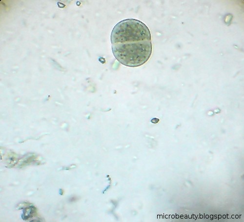 The Wonderful Microworld: Microorganisms in water.