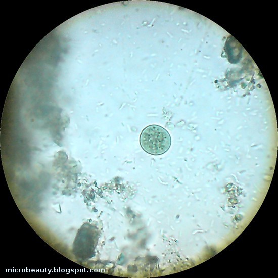 The Wonderful Microworld: Microorganisms in water.