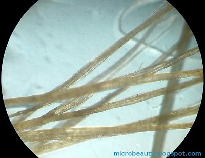 The Wonderful Microworld: Natural Fibers - Jute Fibers