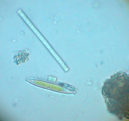 The Wonderful Microworld: Micro Life Forms In The Water - Micro organisms.
