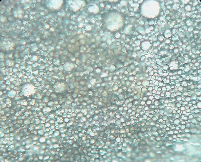 The Wonderful Microworld: Milk and the Curd (Fermented Milk) through ...