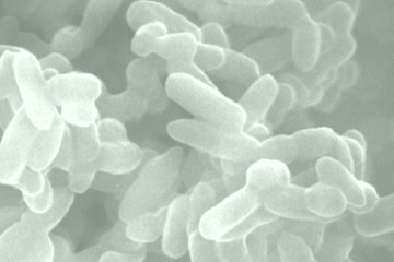 ¡Vamos a Fermentar!: Fermentacion acetica