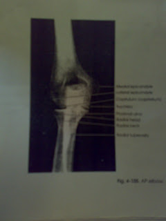Cafe Radiologi: Teknik Radiografi Elbow Joint
