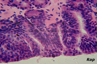 Macro y microfotografia: Microfotografía: Lengua de rana