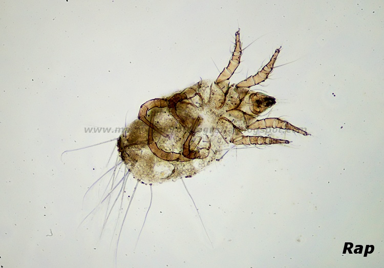 Macro y microfotografia: Microfotografía: Ácaro de agua