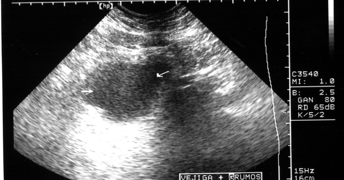 Diario de un Medico II