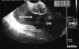 Estatus Post-Laparoscopia