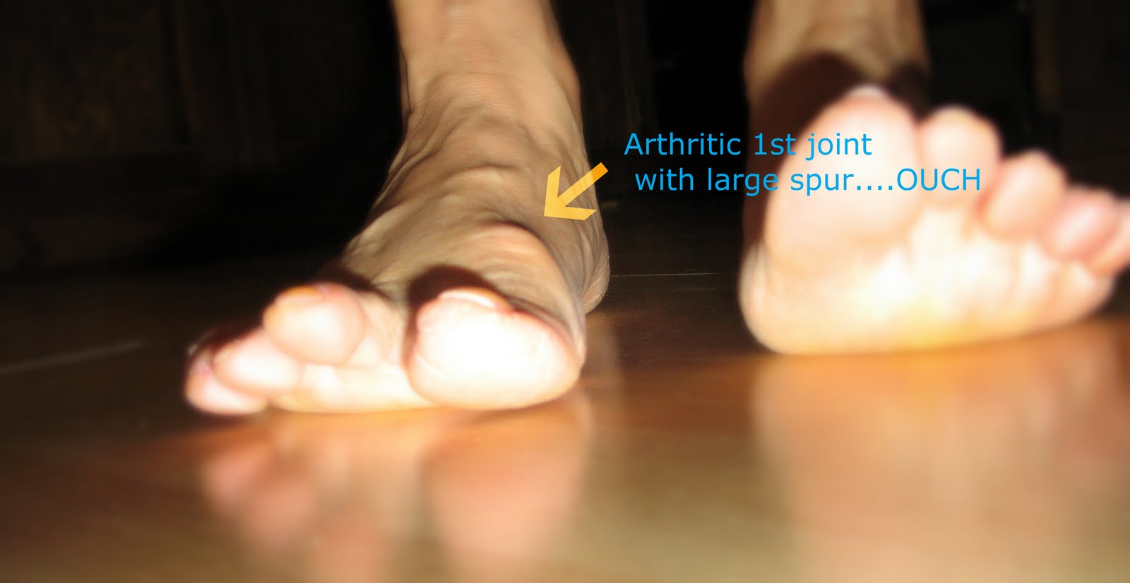 Who will make me laugh: "Arthur" got in my big toe.