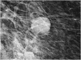 DAPI - Diagnostico Avancado por Imagem: Módulo de Mama, Ginecologia e ...