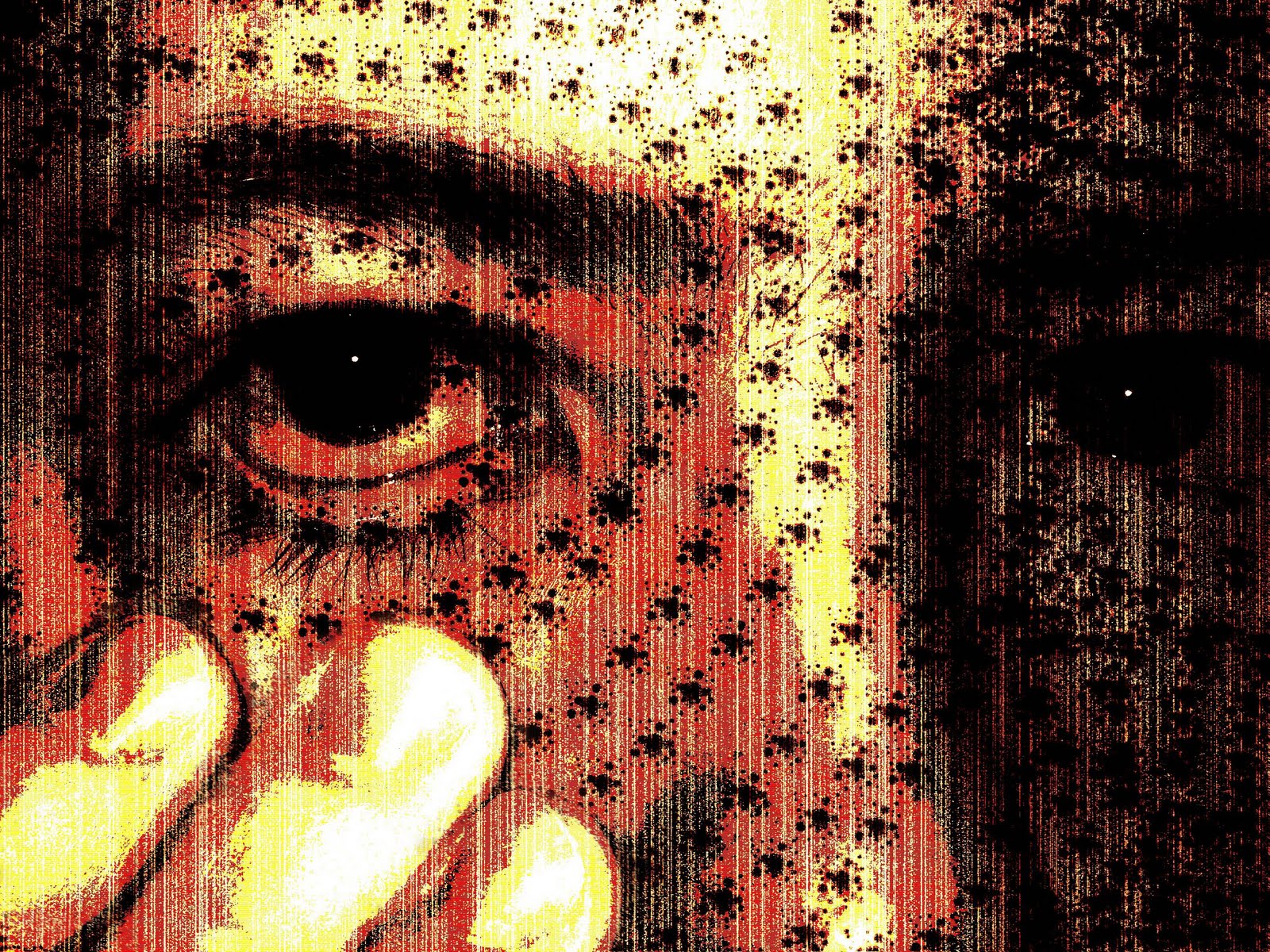 Solomon: The Early Years: Recurrent Corneal Erosion Syndrome