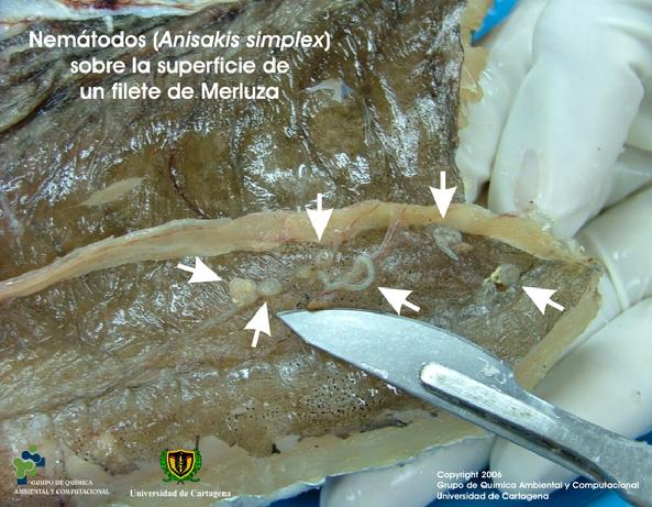 parásito acebichado: ANISAKIS SIMPLEX