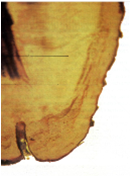 Periodoncia: CEMENTO RADICULAR