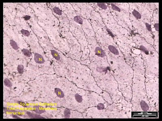 Kinds of Epithelial Tissues