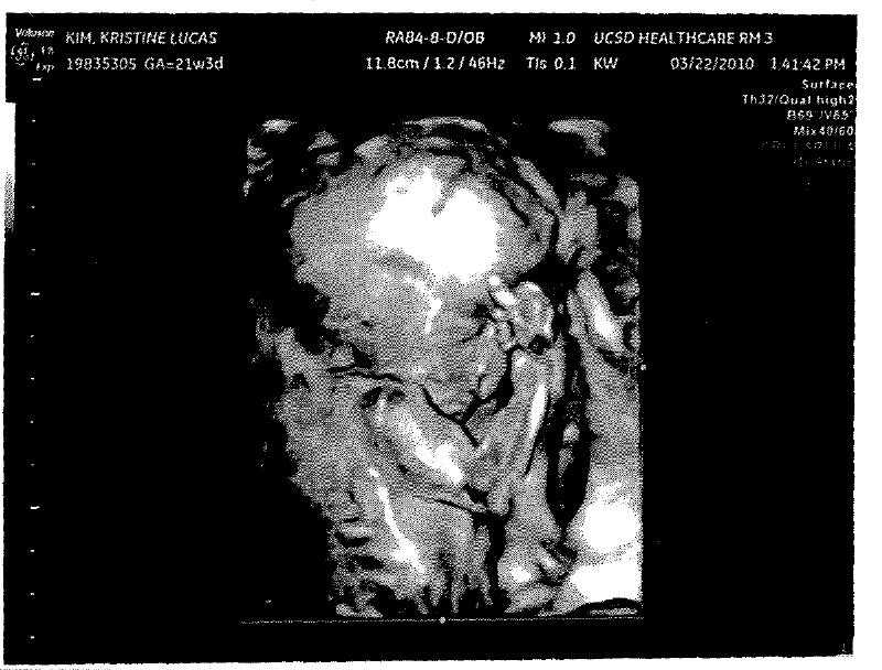 Baby Kimbap!: 3-D Ultrasound