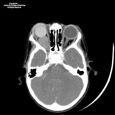 Neuroradiology On the Net: novembre 2010
