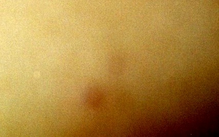 UFOS, ALIENS & MARKS: PICS OF MARKS