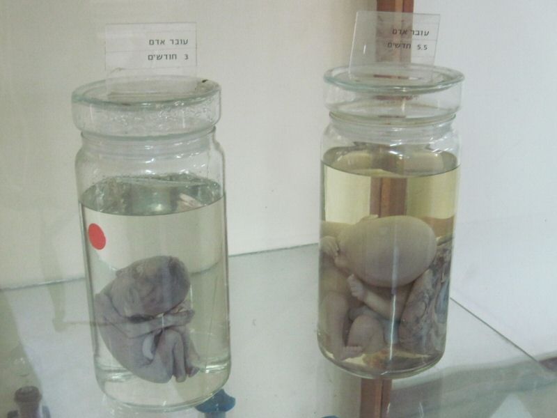 Allergic to Coleslaw: A Day in Haifa, Part IV: Gross Pickled Animals