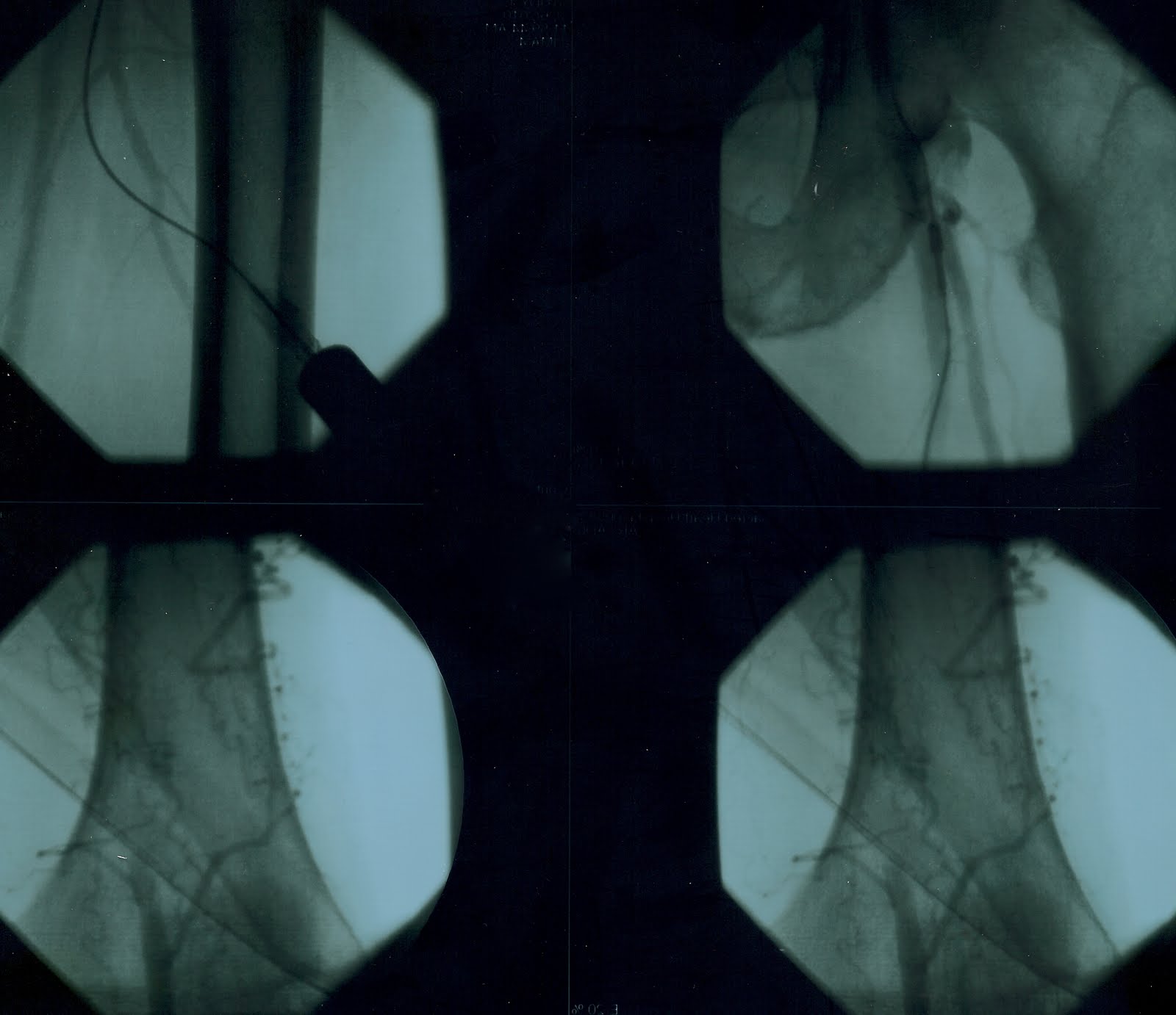 Cleveland Foot and Ankle Case Blog