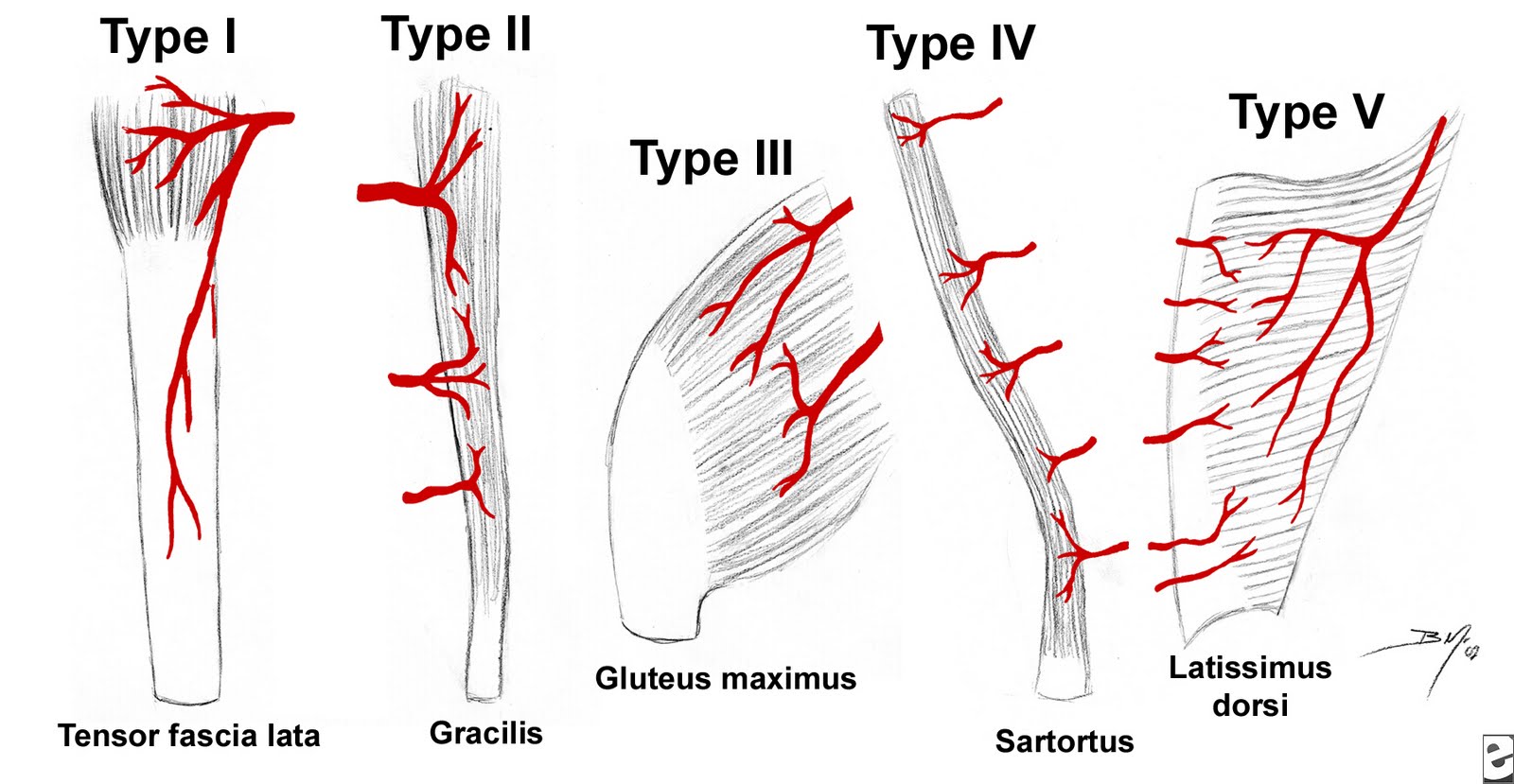 MEDICAL: Flap Surgery