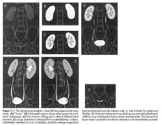 Kautsar Prastudia: Radiologi BNO-IVP
