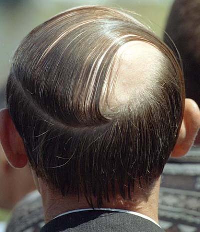 Bandenchef: Scheitel........