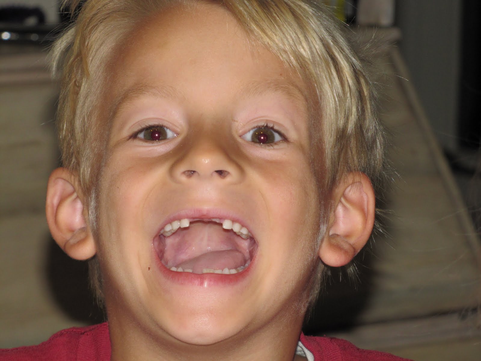 Arkansas Watsons: All I want for Christmas is my two front teeth!