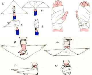 Socorrismo: VENDAJES