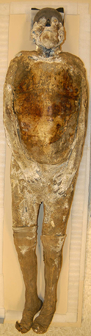 marcelo aviz: Saiba o que é Saponificação Cadavérica