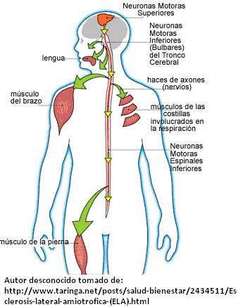 ELA: Historia de la ela (Esclerosis lateral amiotrofica)