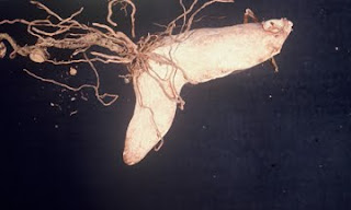 POISONOUS PLANTS OF SRILANKA: GLORRY LILLI (NIYAGALA)