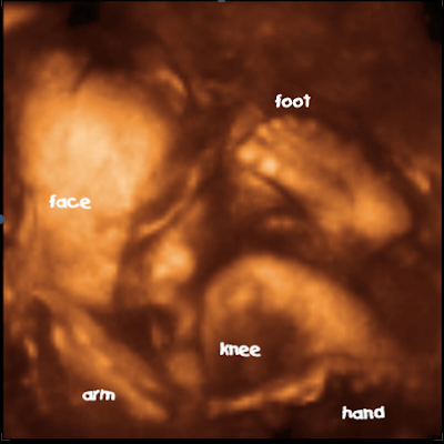Craig and Mandy's Baby Boy: 27 weeks 3D ultrasound pictures and video