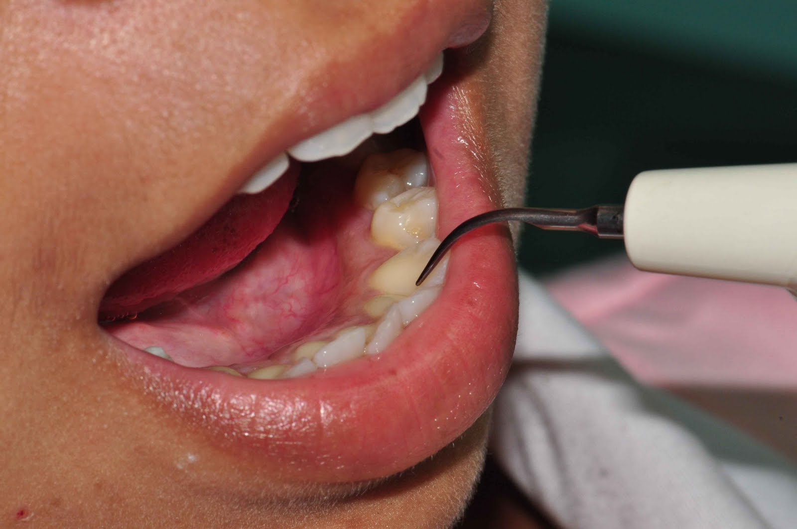 Prestige Dental Care: Why we need regular dental check-up? Prestige Dental Care: Why we need regular dental check-up?