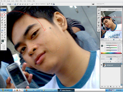 Digital Imaging-TRICK: The effect of the scratch wound on the face