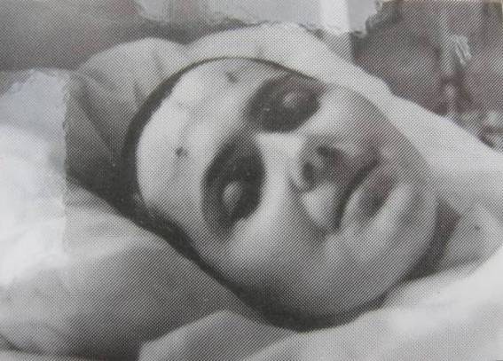 Stigmata Therese Neumann